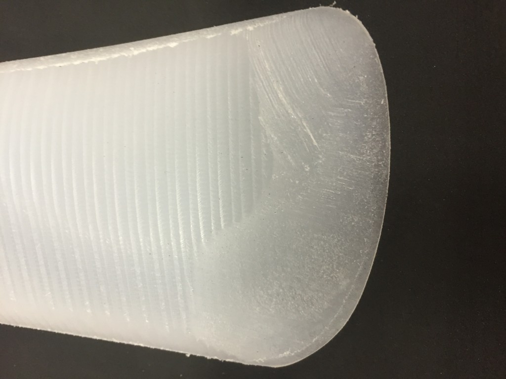 Posting | Sound Orthotics