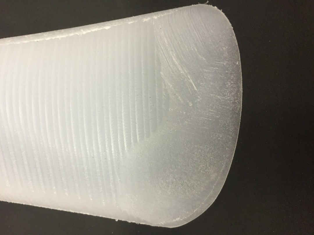 Posting | Sound Orthotics